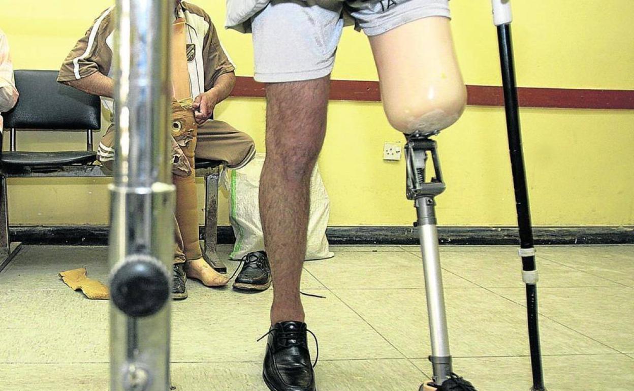Cuantos días durará el dolor de una pierna amputada: Consejos para ...